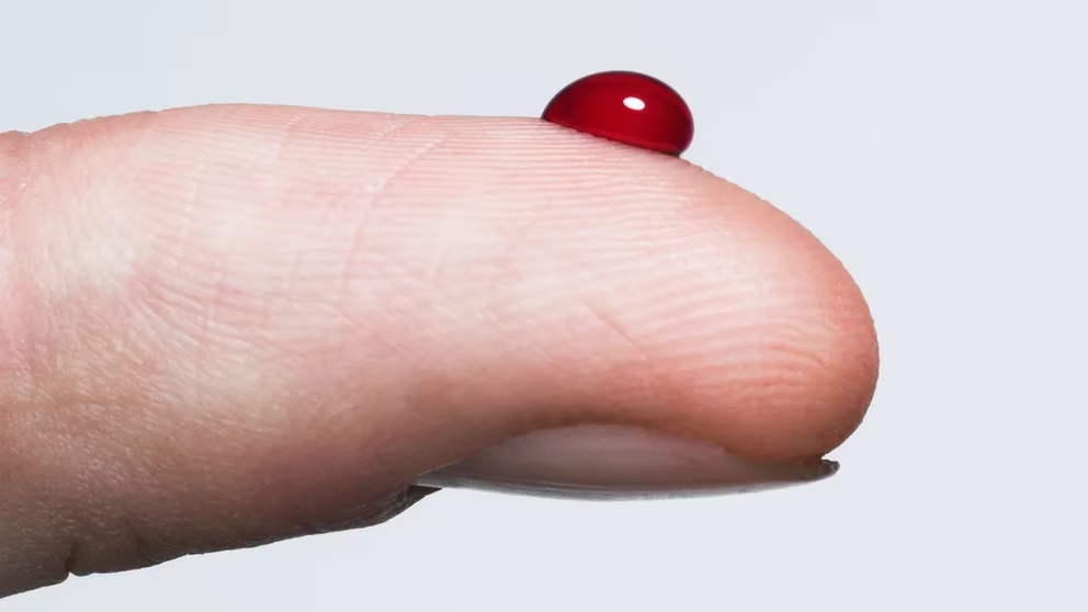 Hematofobia: ¿por qué algunas personas se marean o desmayan al ver ...